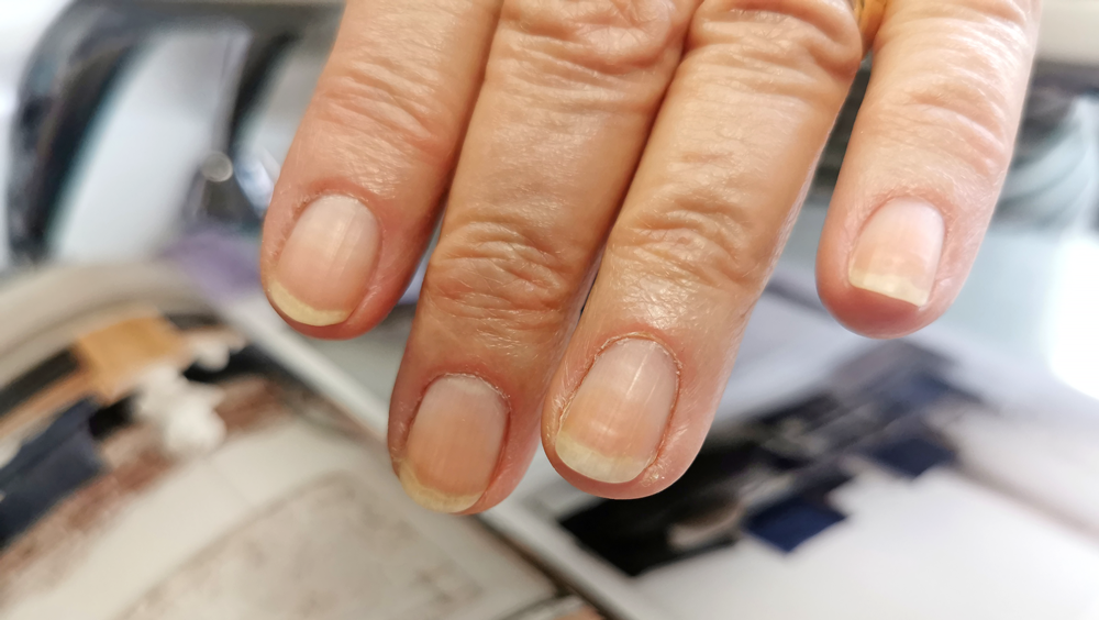 Slik får du fine negler - Fixit